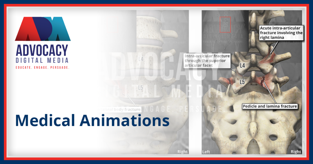 Medical Animations | Advocacy Digital Media