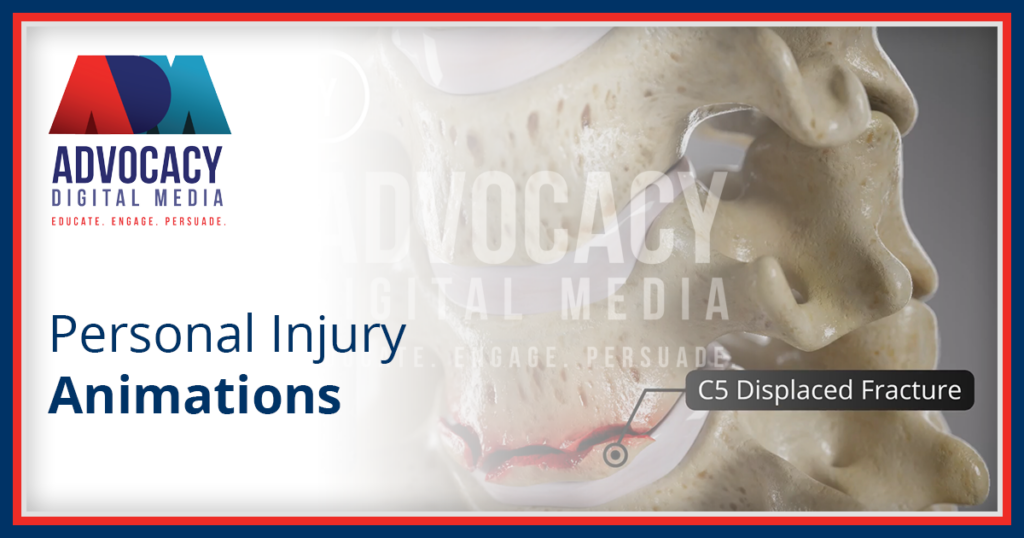 Personal Injury Animations | Advocacy Digital Media